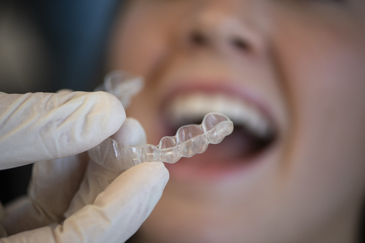 Invisalign - Orthodontix
