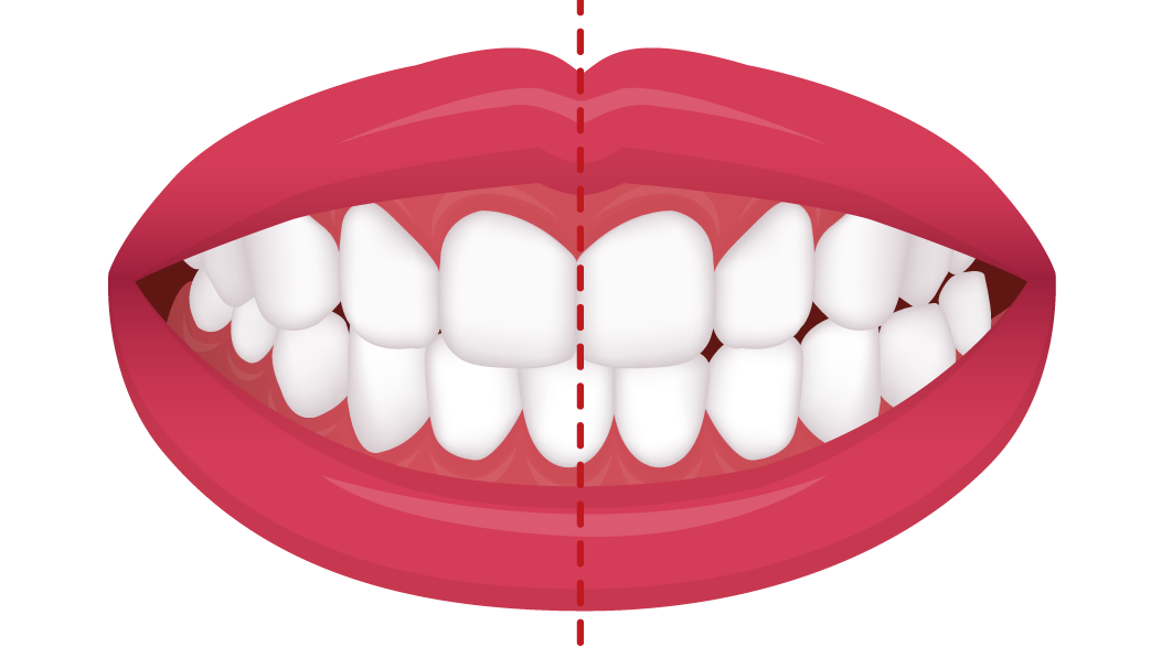 Before & Afters - Orthodontix