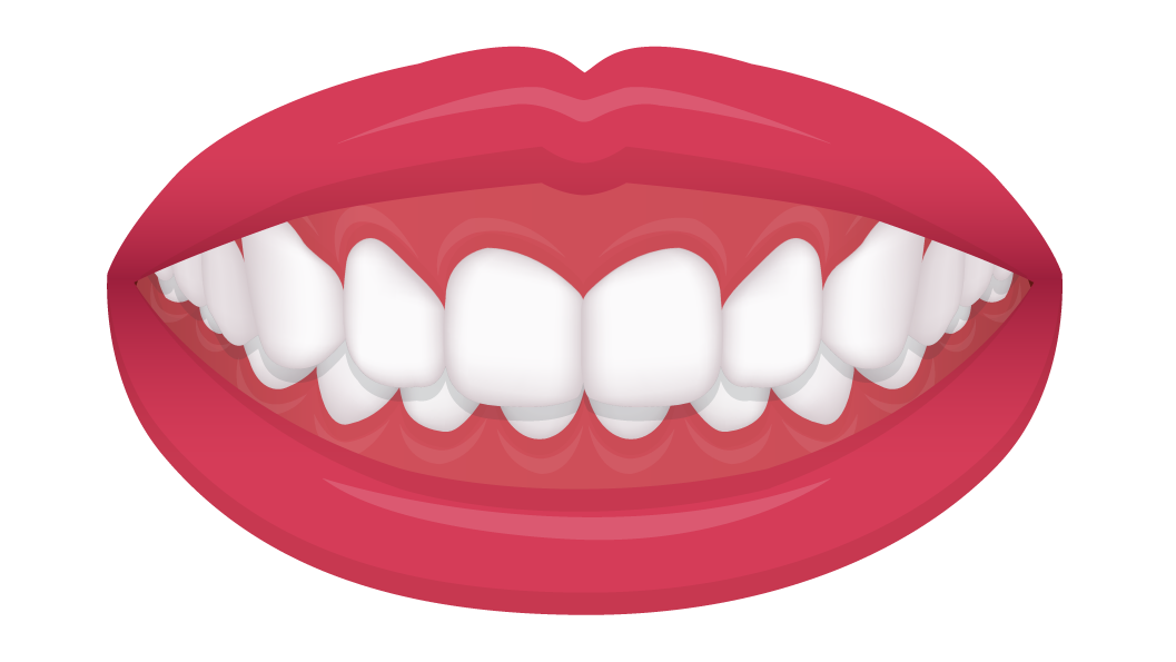 Before & Afters - Orthodontix