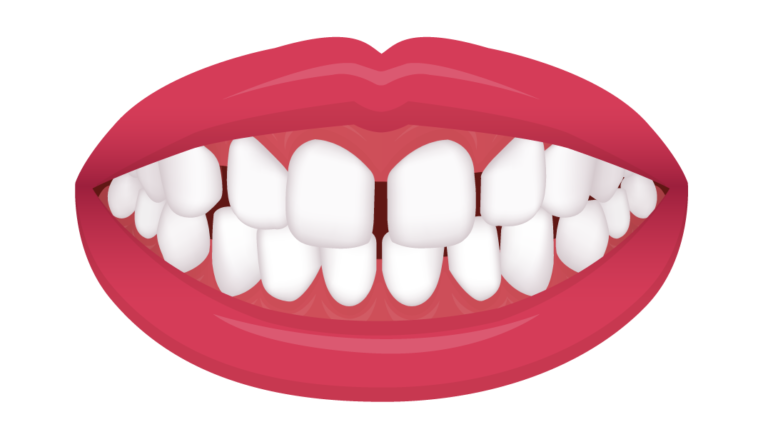 Before & Afters - Orthodontix