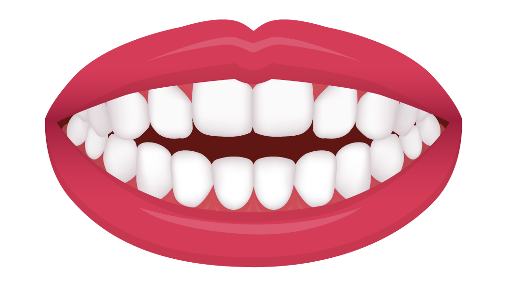 Before & Afters - Orthodontix