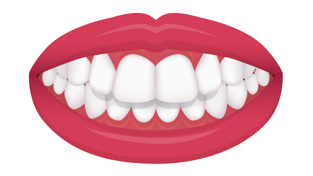 Before & Afters - Orthodontix