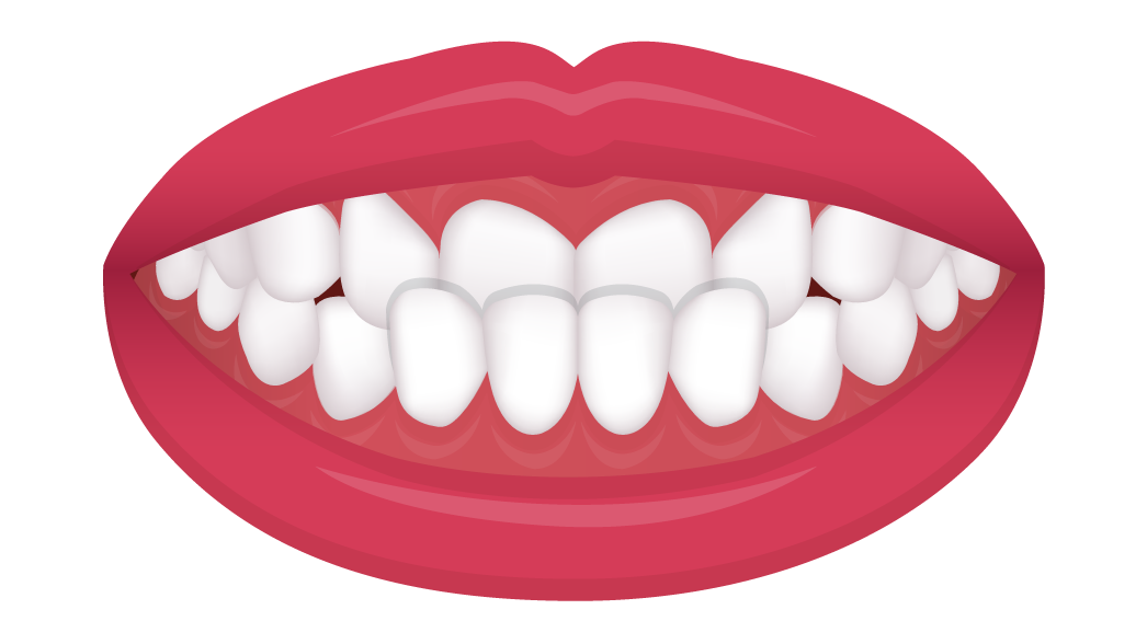 Before & Afters - Orthodontix