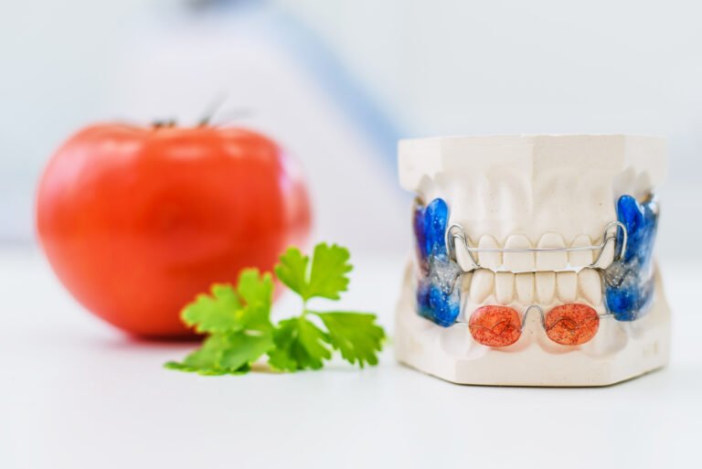 Twin Blocks and What to Expect - Orthodontix